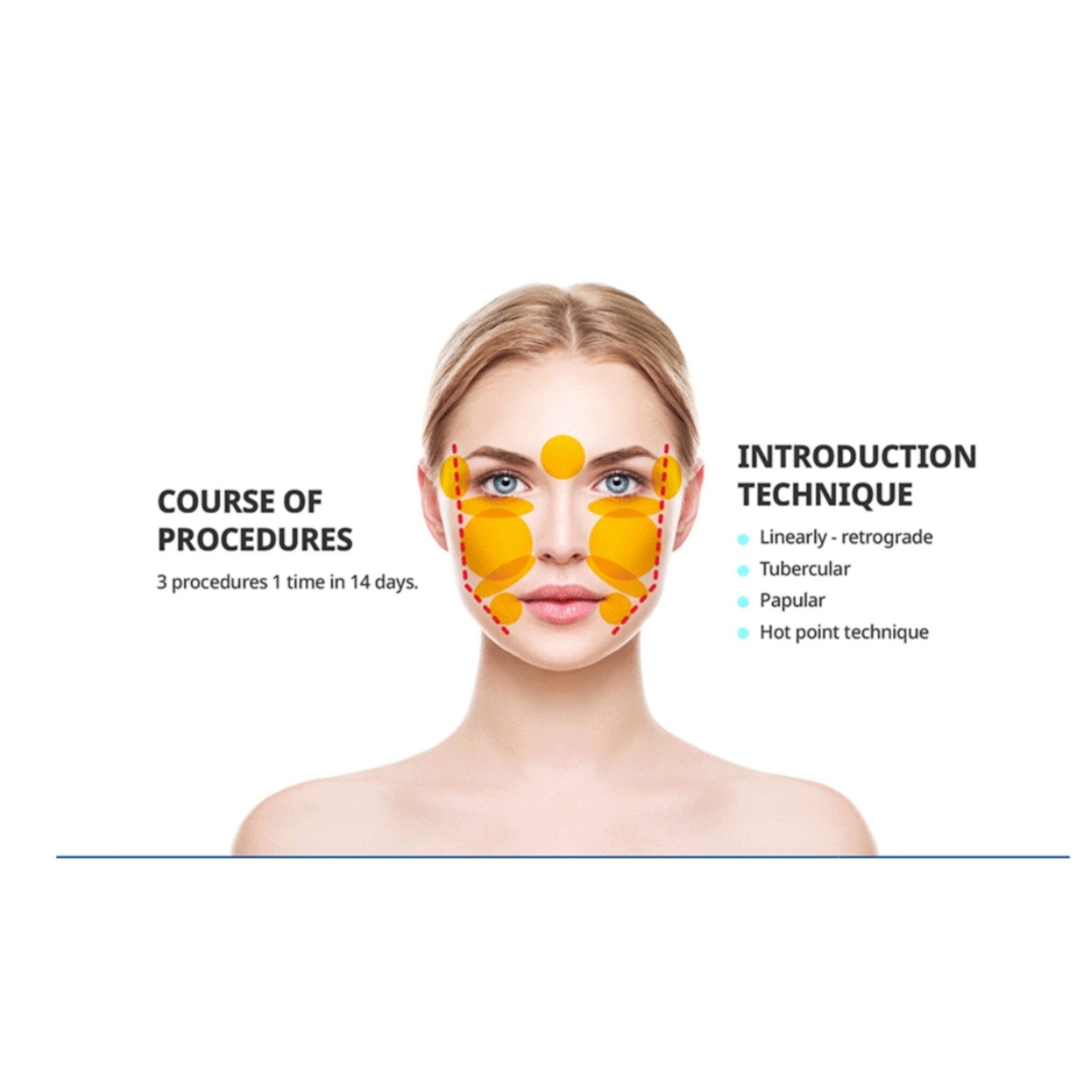 Skin Boosters - Aesthetics-Shop